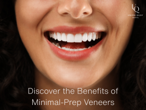 Discover the Benefits of Minimal-Prep Veneers | Union Quay Dental